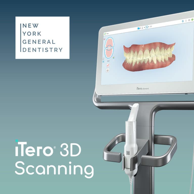 Why Choose the iTero Element Scanner? - New York General Dentistry
